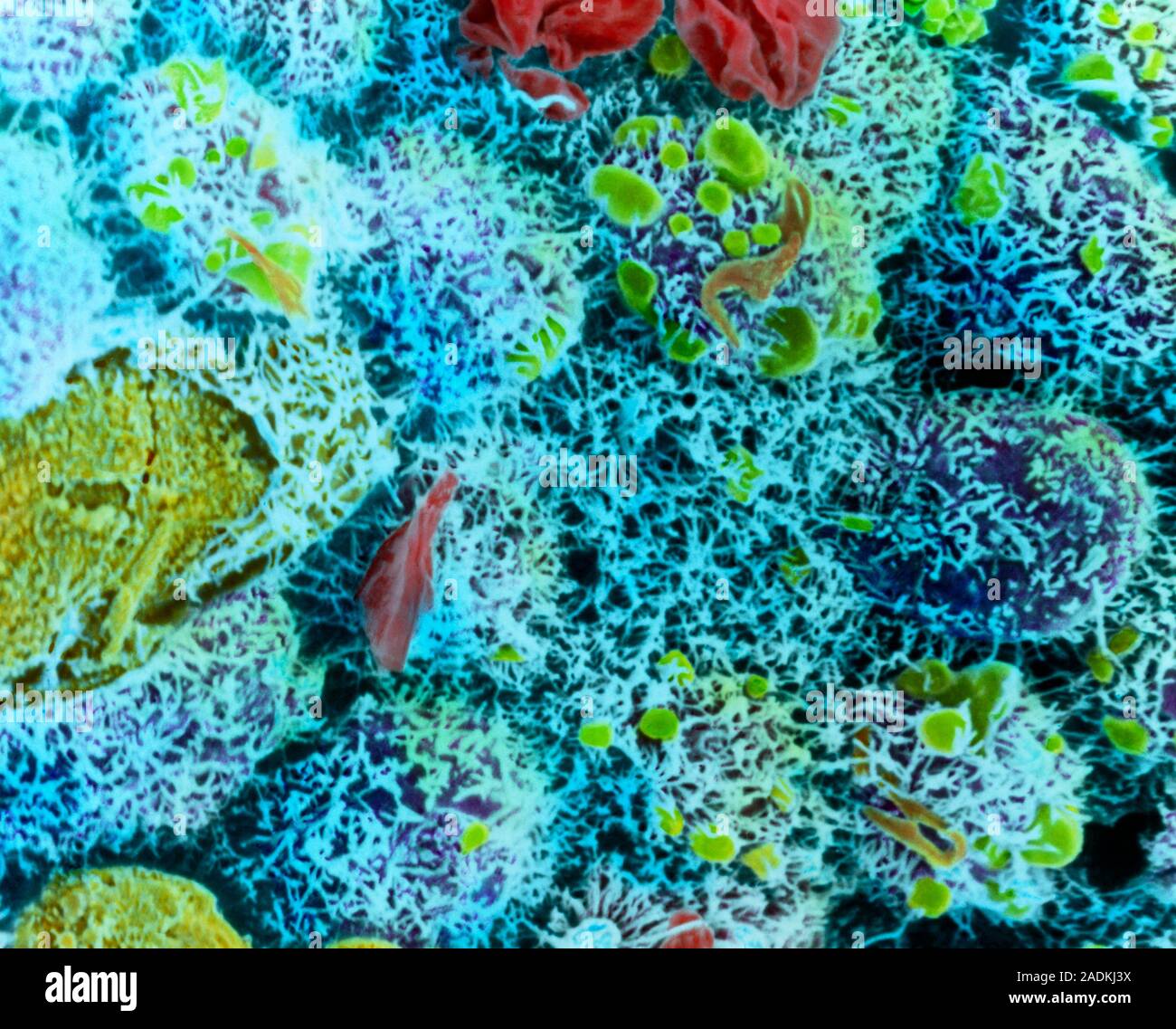 Large intestine. Coloured scanning electron micrograph (SEM) of the ...