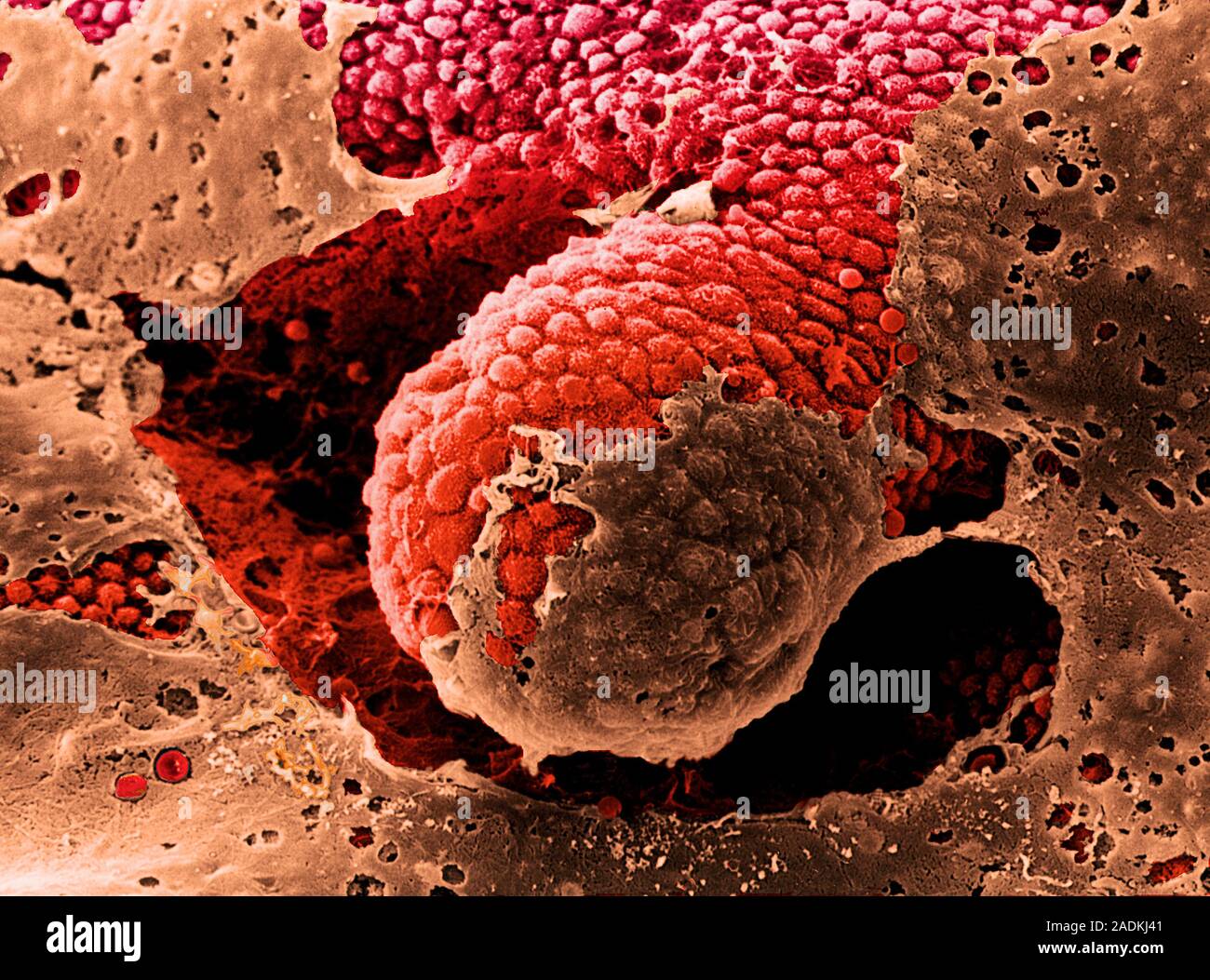 Large Intestine Mucosa Coloured Scanning Electron Micrograph Sem Of The Mucosa Lining Of