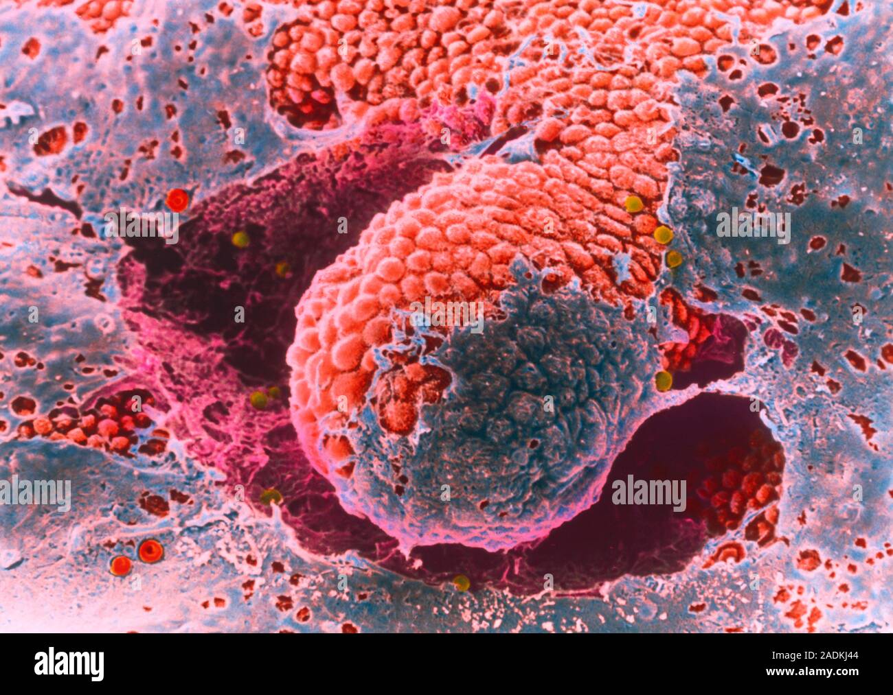 Large intestine mucosa. Coloured scanning electron micrograph (SEM) of ...