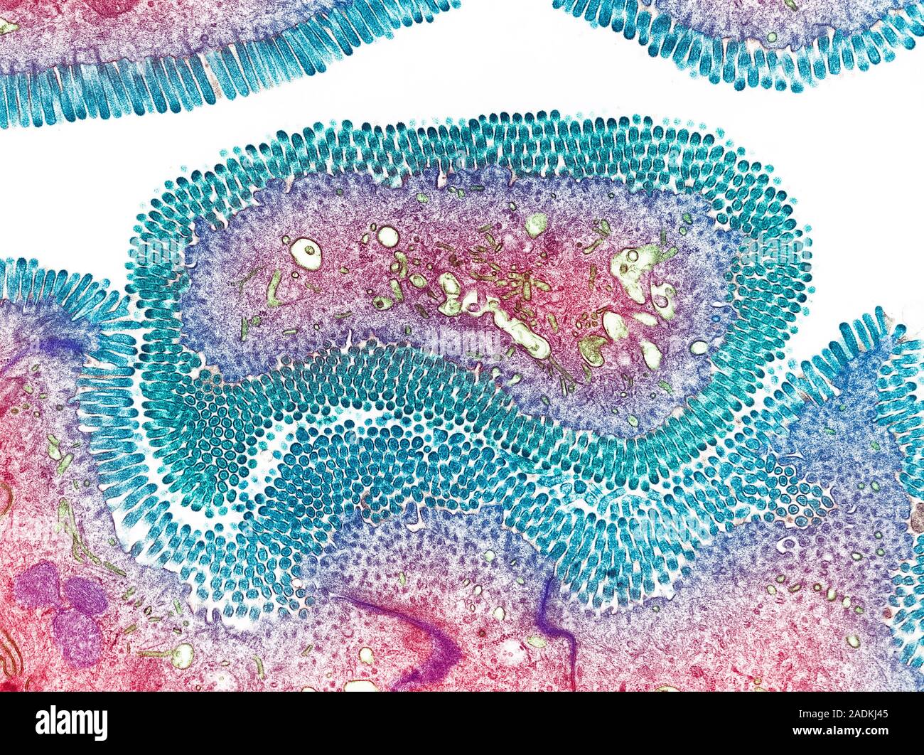 Large intestine. Coloured transmission electron micrograph (TEM) of a ...