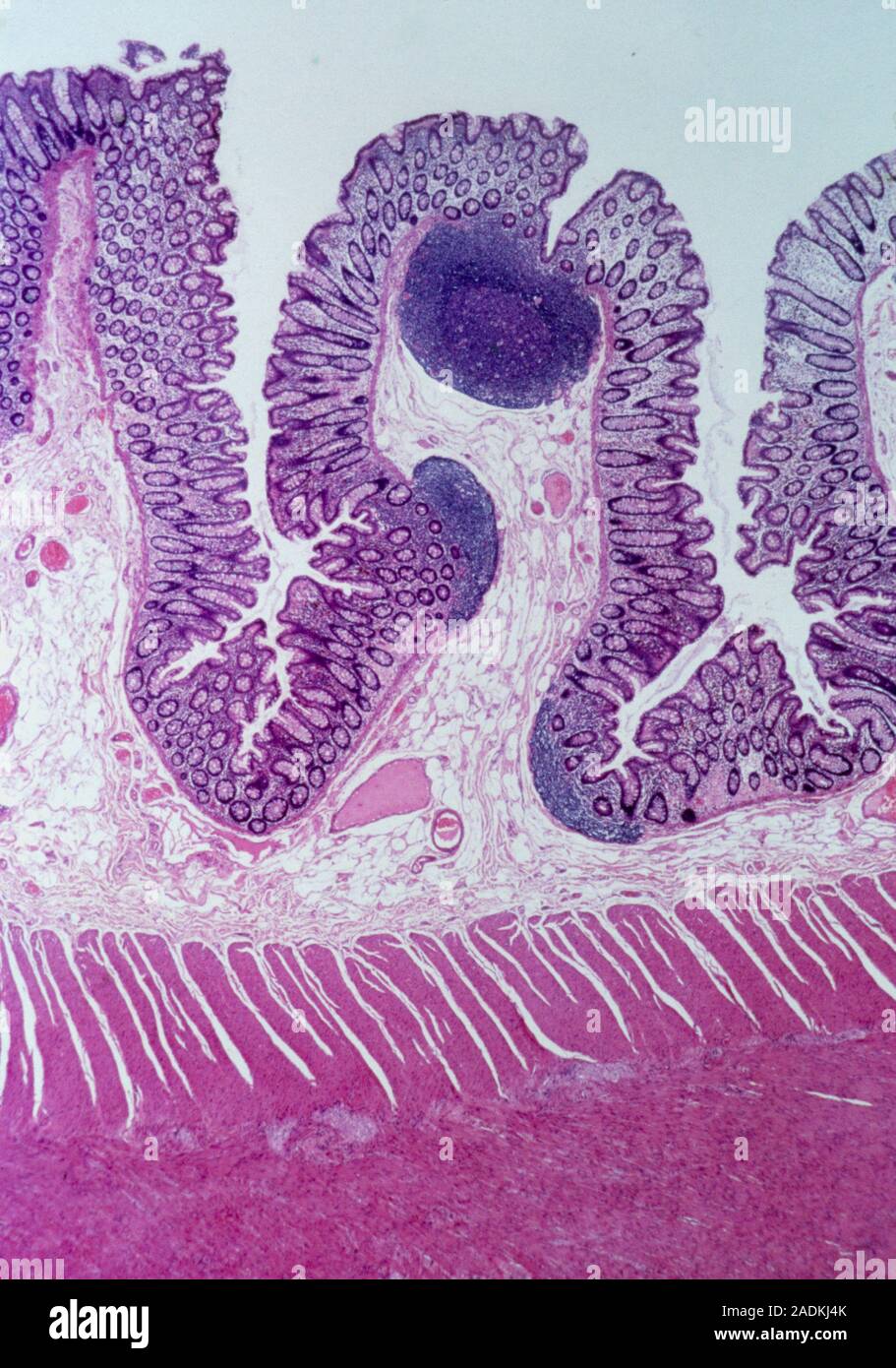 Colon lining. Light micrograph of a section through a human colon ...