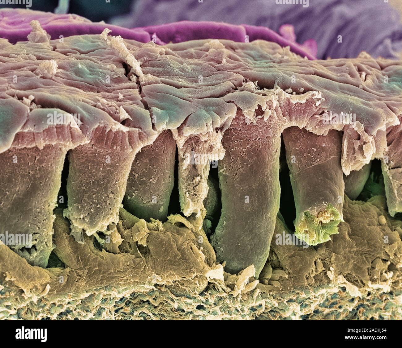 Large intestine lining. Coloured scanning electron micrograph (SEM) of ...