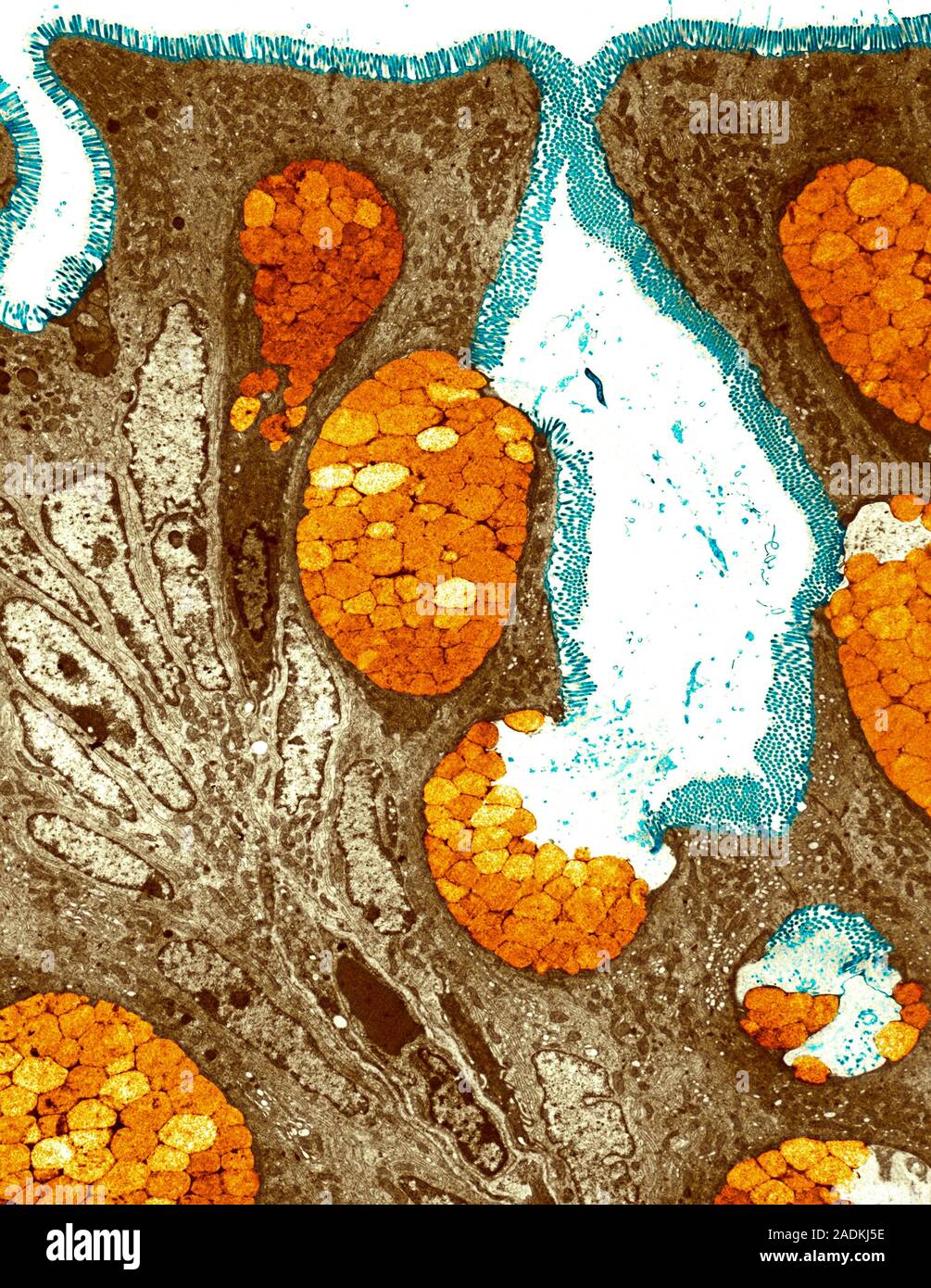 Large intestine. Coloured transmission electron micrograph (TEM) of a ...