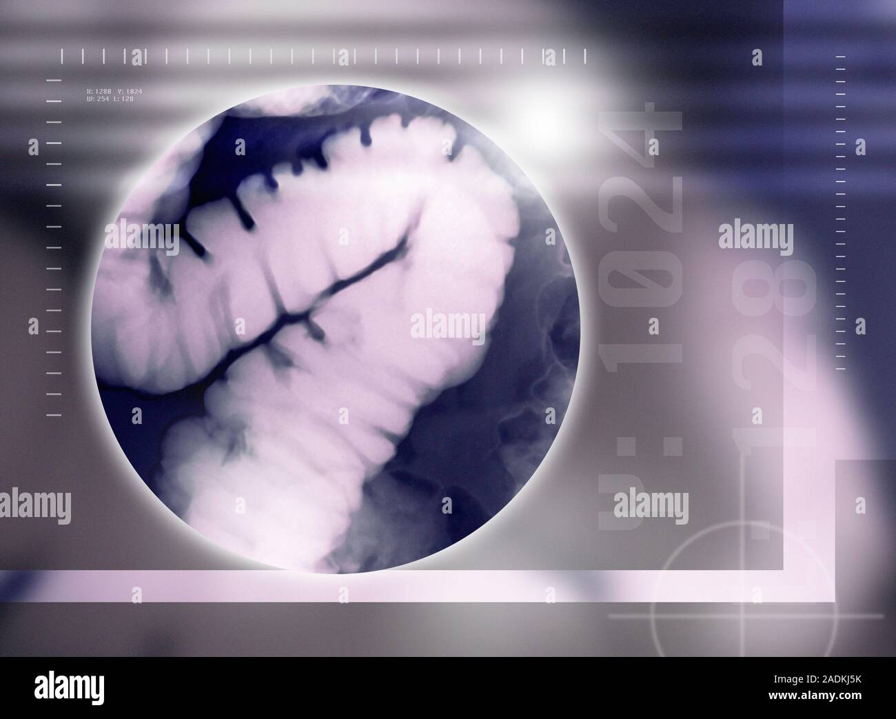 Large intestine, coloured computed tomography (CT) scan. The large ...