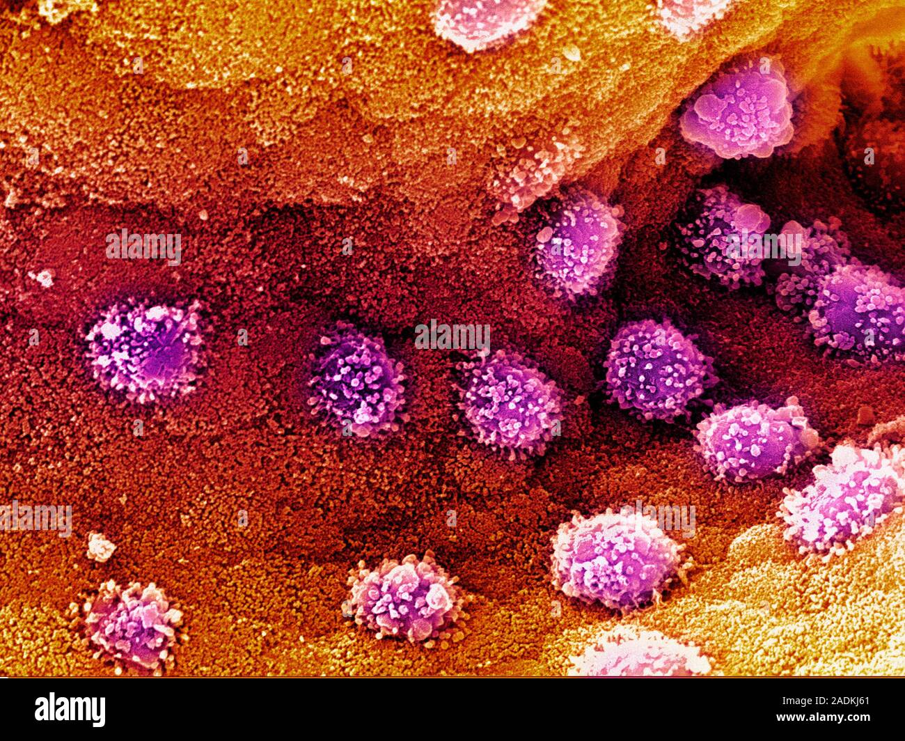 Colon goblet cells. Coloured scanning electron micrograph (SEM) of a ...