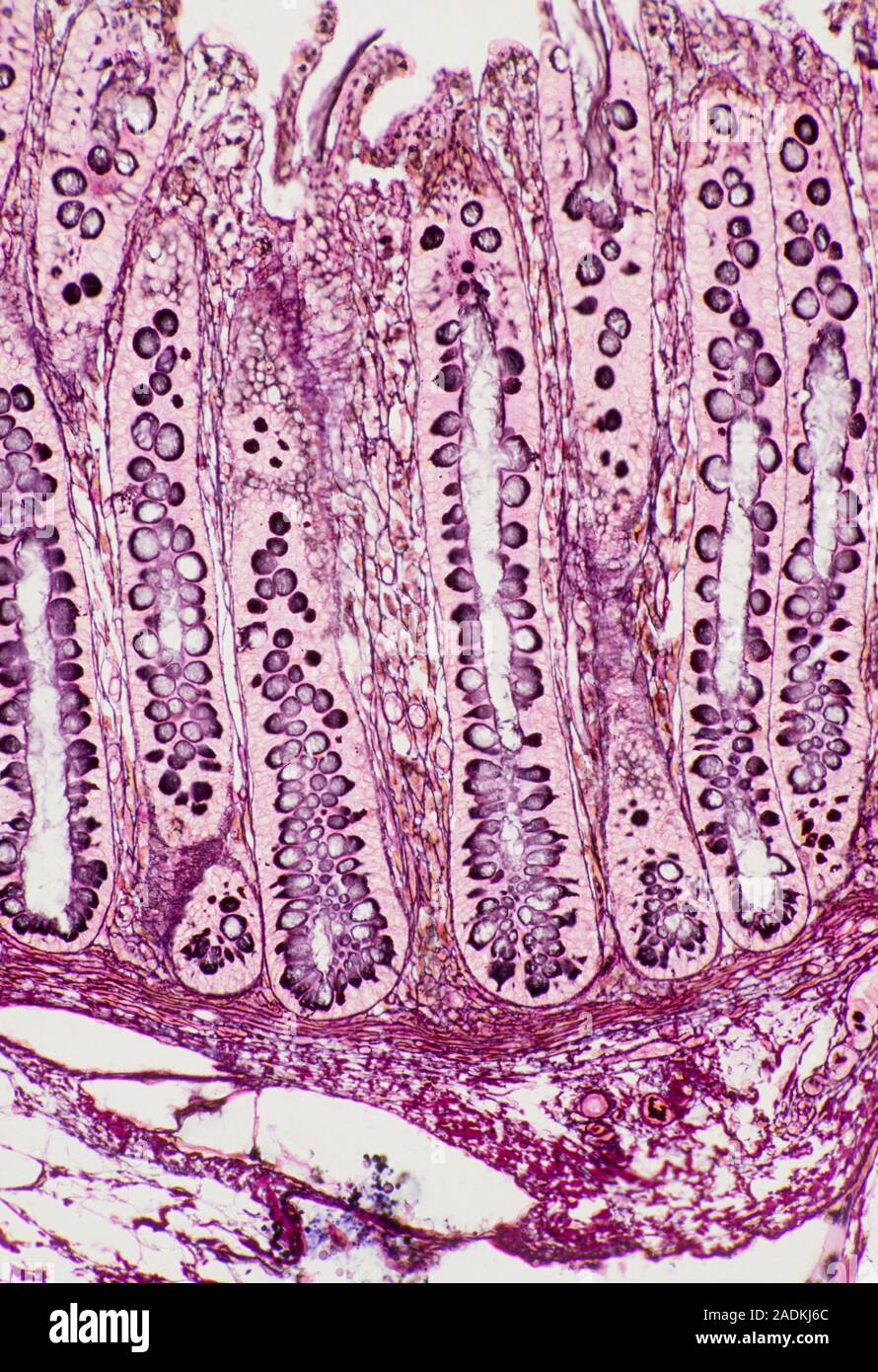 Intestinal villi. Light micrograph of a section through villi on the ...