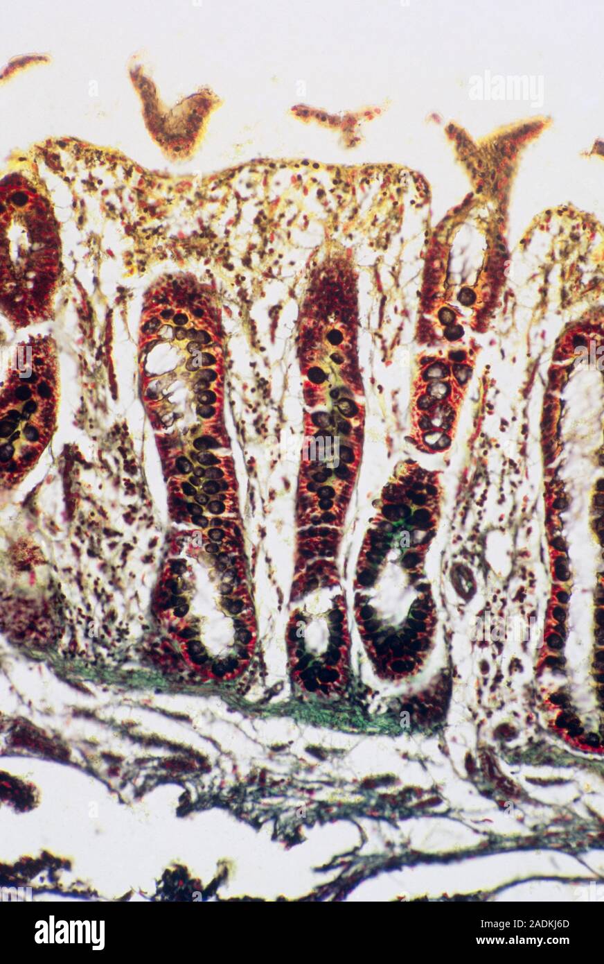 Intestinal villi. Light micrograph of a section through villi on the ...