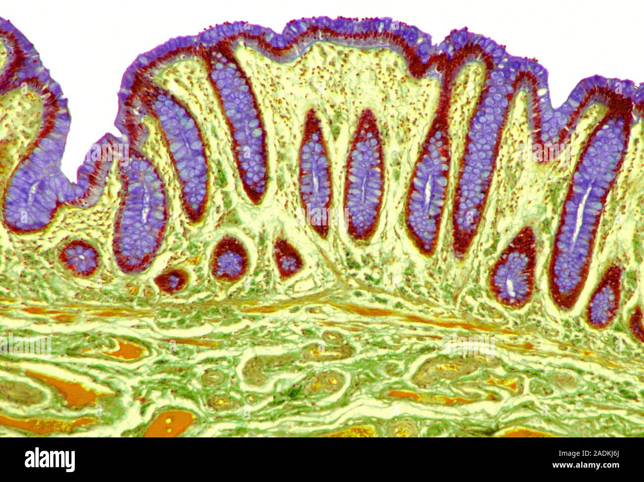 Colon lining. Coloured light micrograph of a section through a human ...