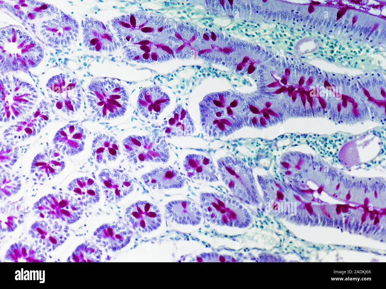Colon lining. Coloured light micrograph of a section through a human ...