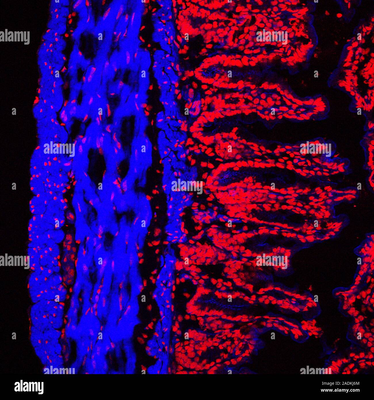 Colon lining. Fluorescence confocal light micrograph of the lining of a ...