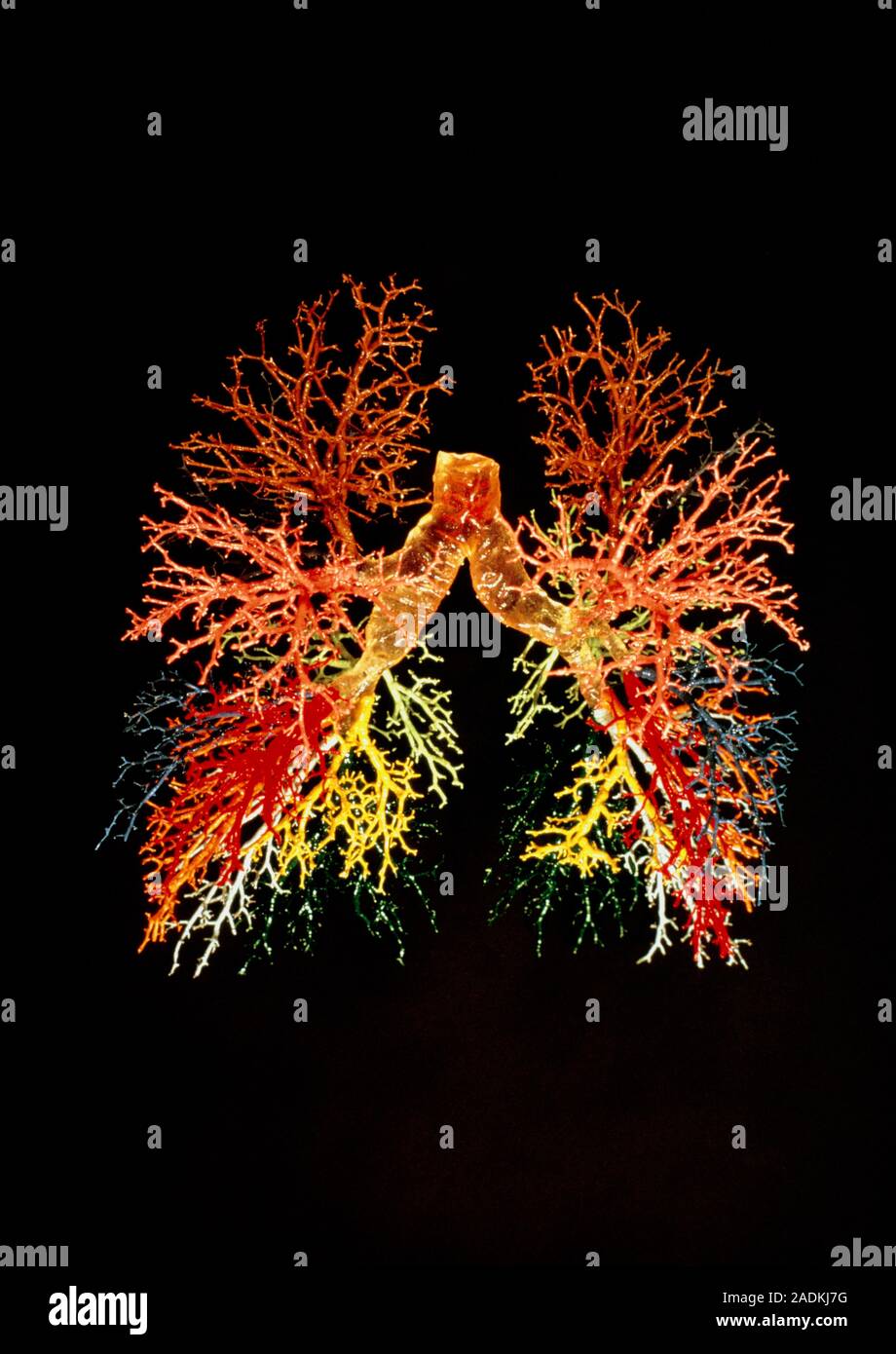 Resin cast of the adult human lower trachea & bronchial tree. The ...