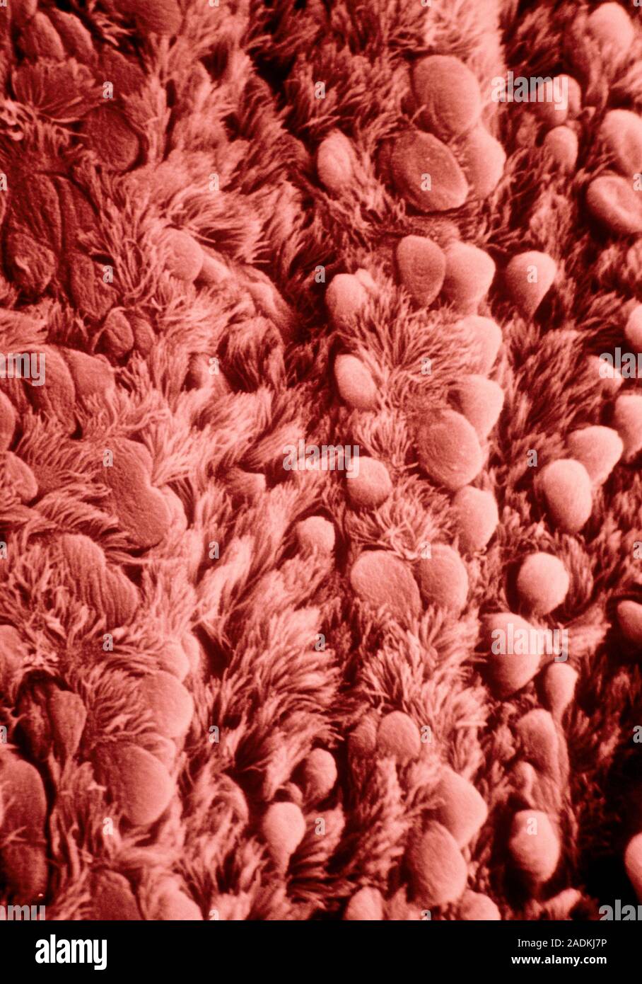 False-colour scanning electron micrograph (SEM) of the internal lining ...