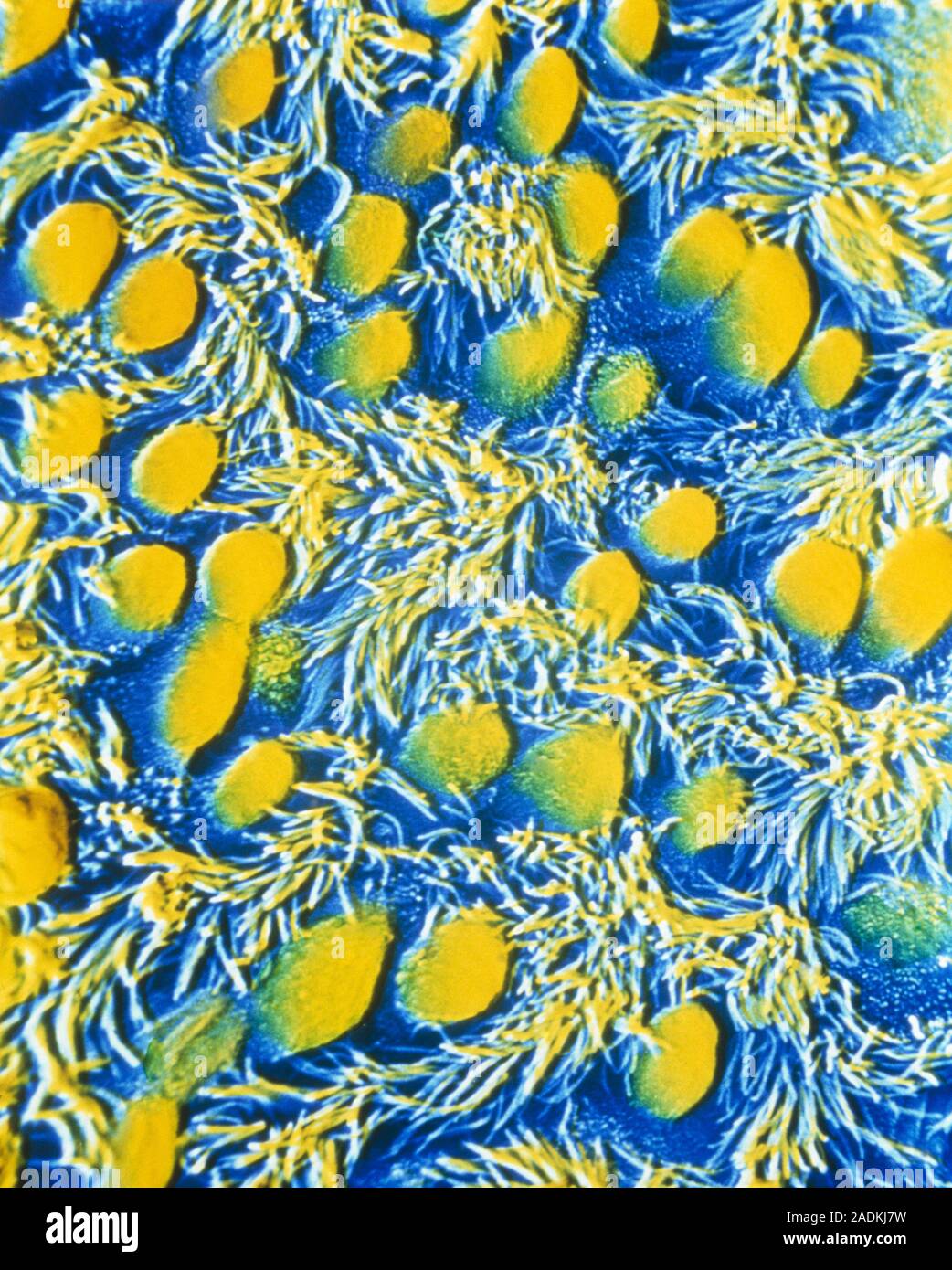 False-colour scanning electron micrograph (SEM) of the internal lining ...