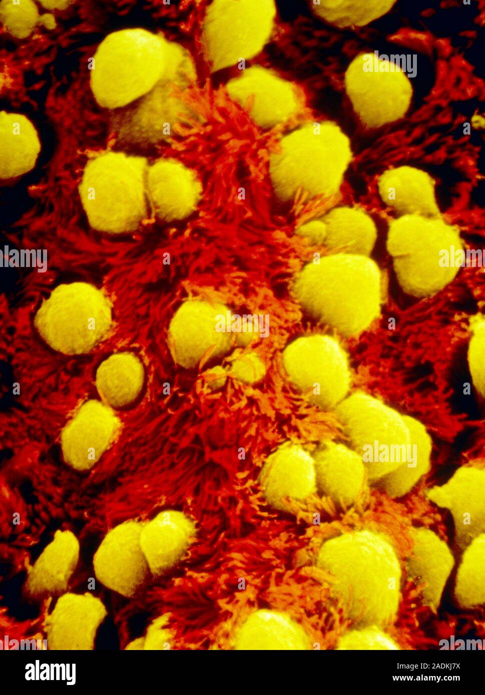 False-colour scanning electron micrograph (SEM) of the internal lining ...