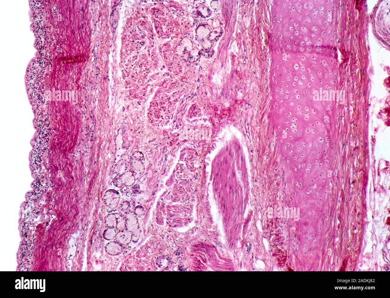 Light micrograph of the human trachea (windpipe). The epithelium (layer ...