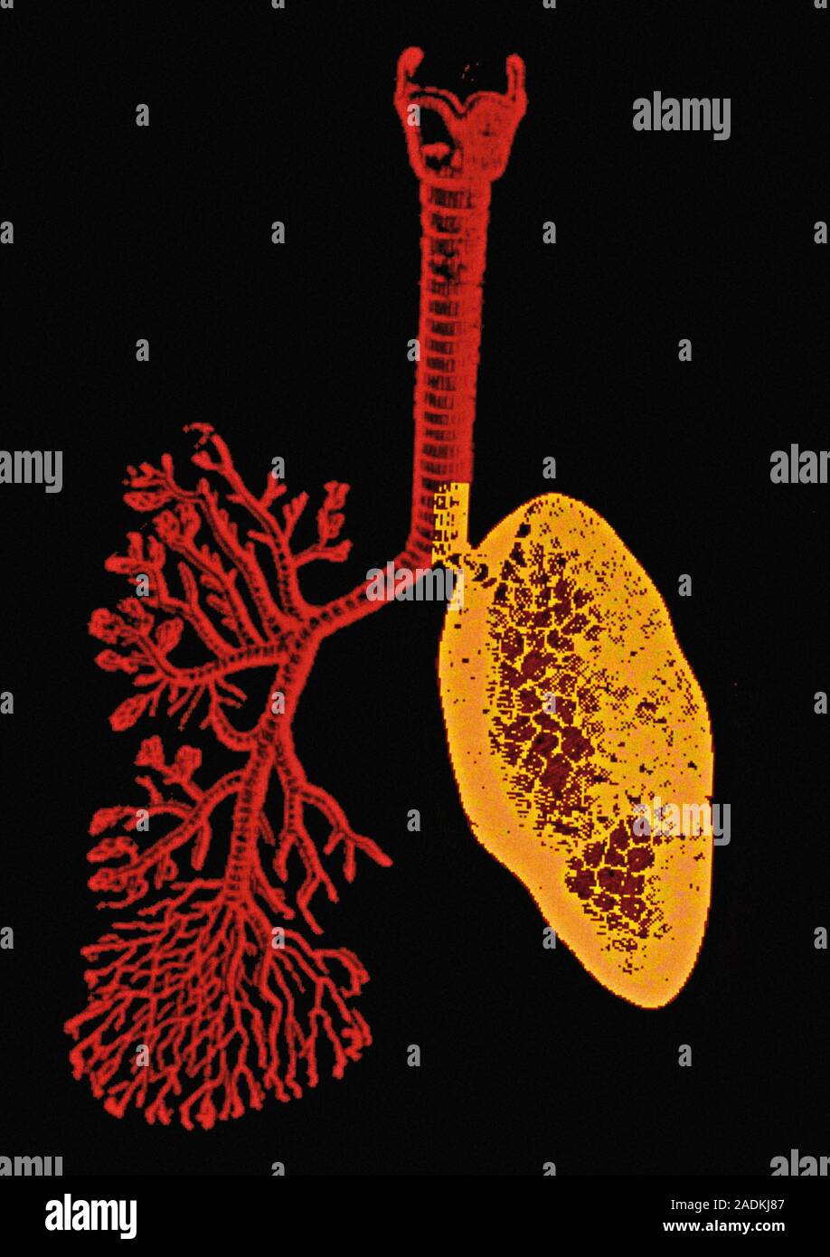 Computer digitised illustration of a human lung, trachea and bronchiole ...