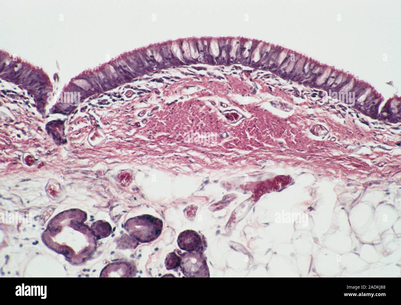 Light micrograph of a longitudinal section of the trachea with lumen ...
