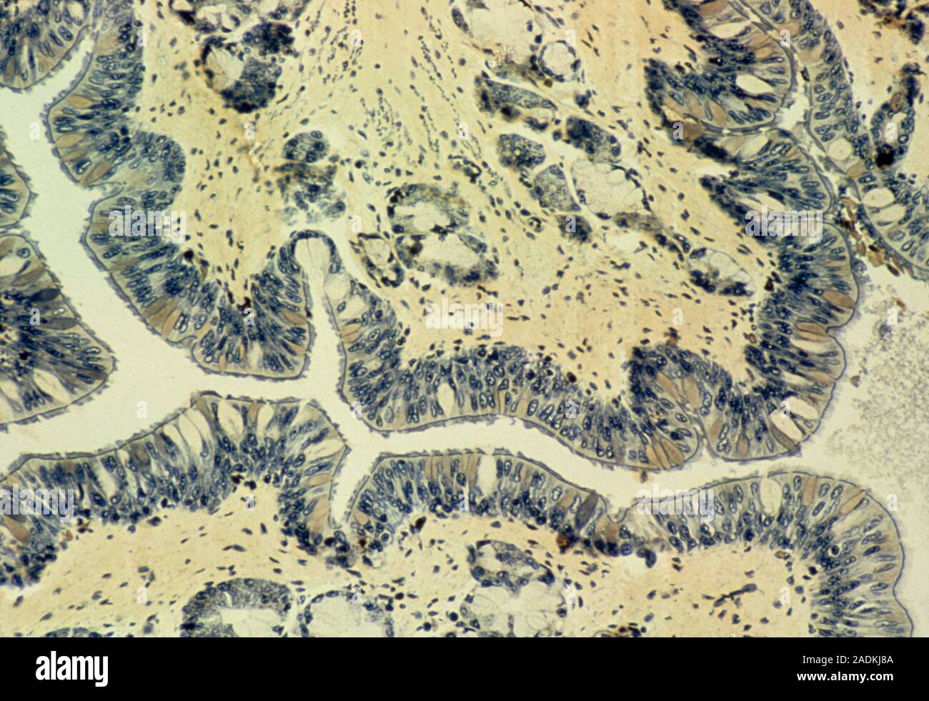 Trachea epithelium. Light micrograph of a section through the wall of ...