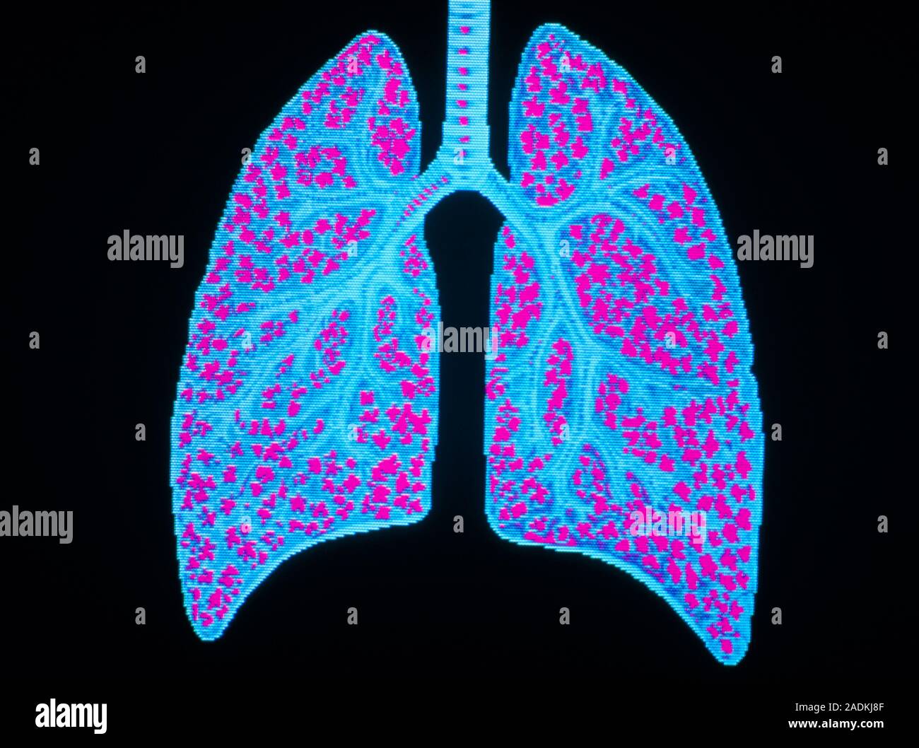 Lung anatomy. Computer digitised, historical illustration of the human ...