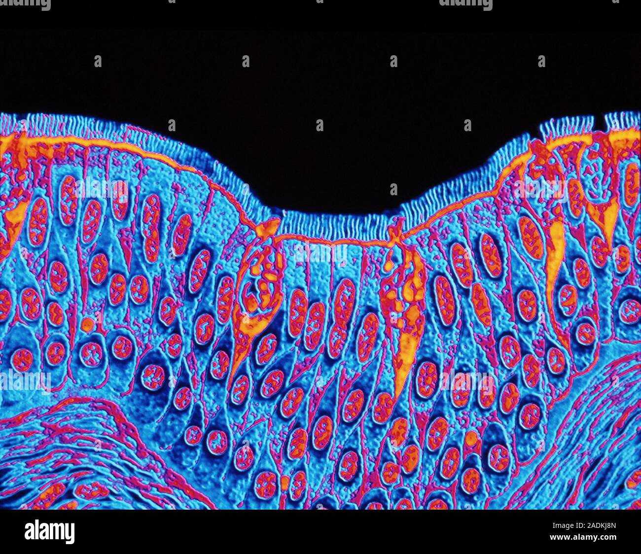 Trachea epithelium. Coloured light micrograph of a section through the ...