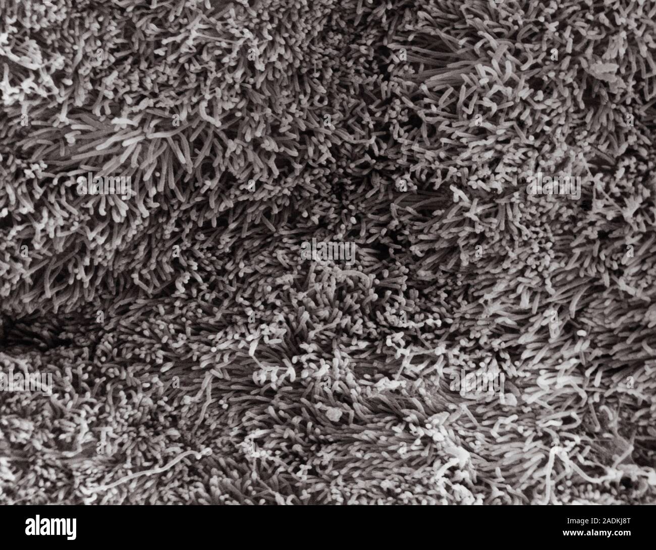 Tracheal epithelium. Scanning electron micrograph (SEM) of the internal ...