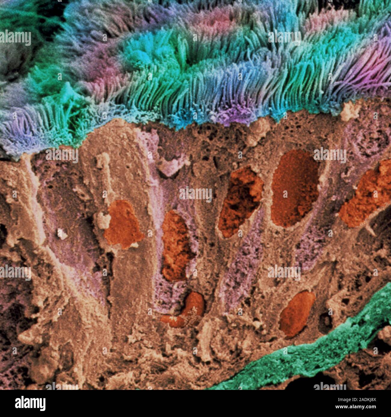Lung lining. Coloured Scanning Electron Micrograph (SEM) of a section ...