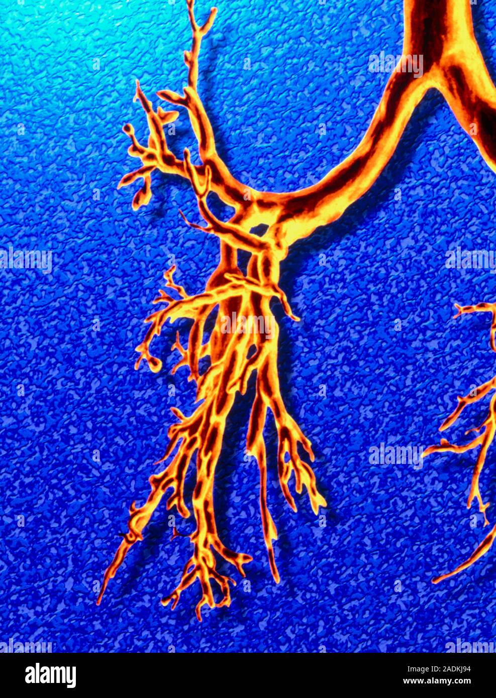 Healthy lung airways. Computer artwork showing the internal anatomy of ...