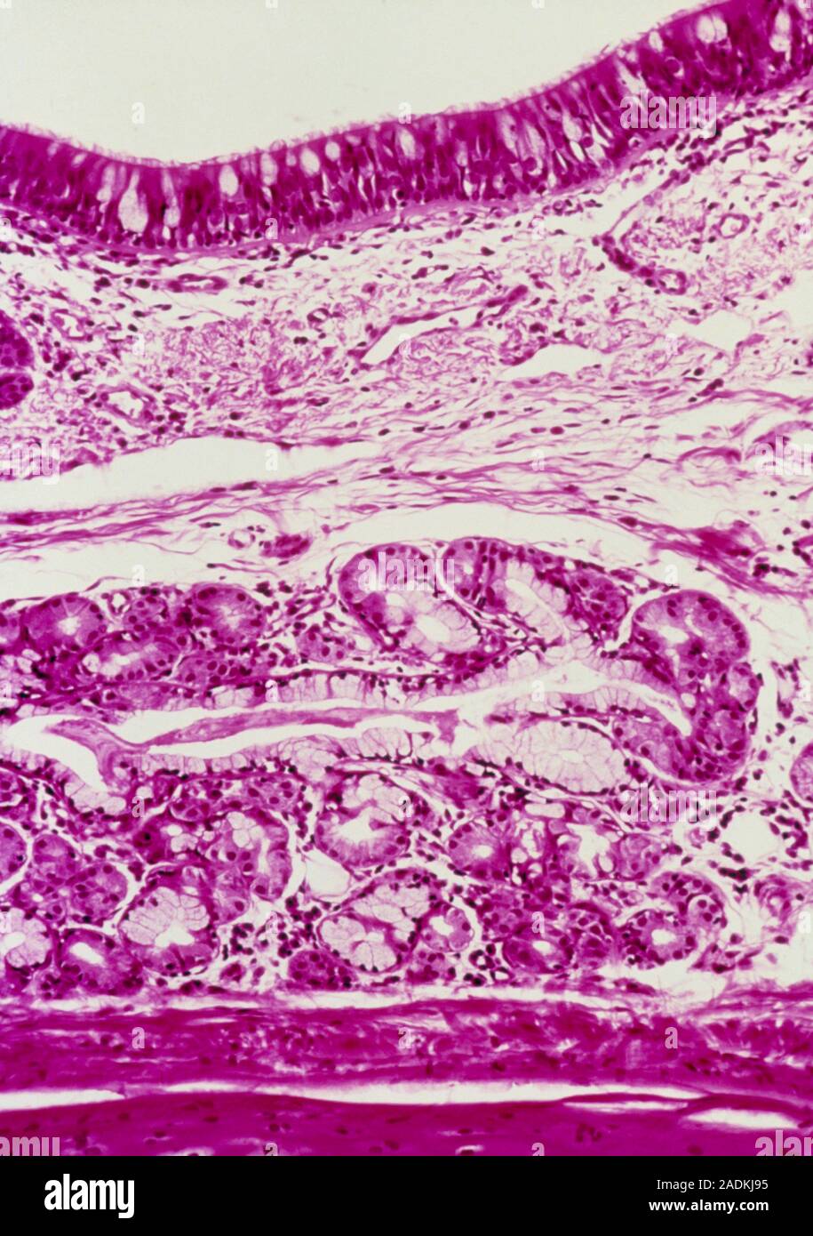 Windpipe. Light micrograph of a section through the windpipe (trachea ...