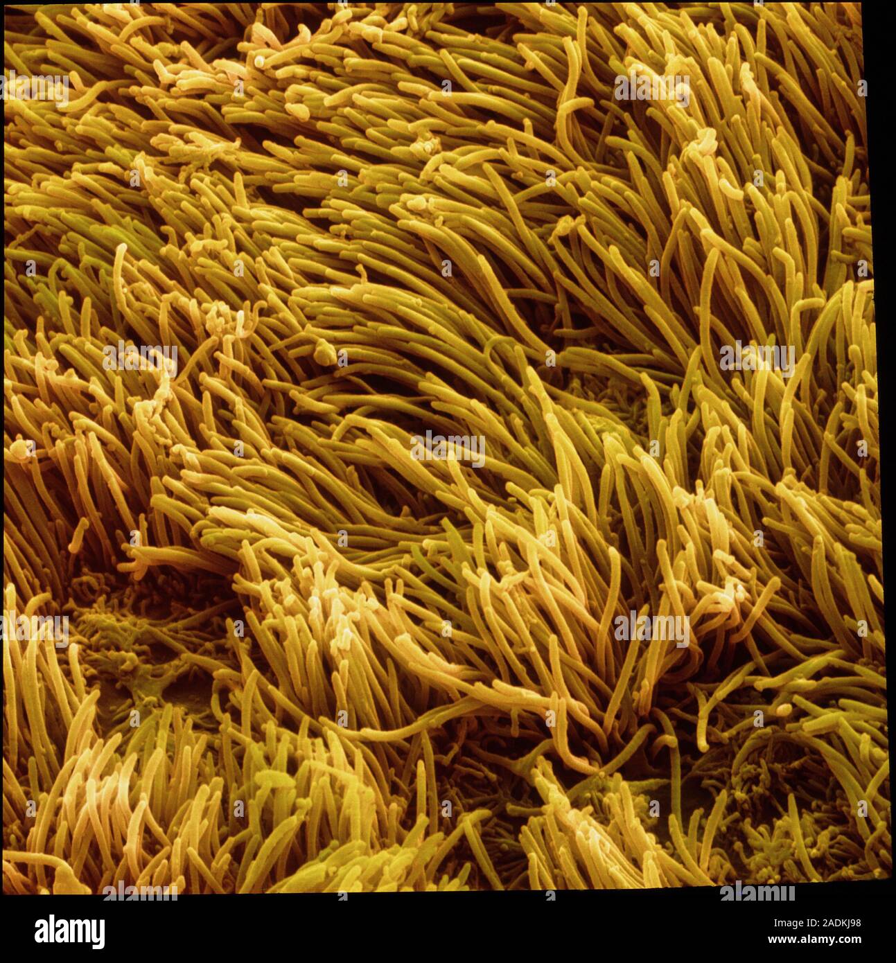 Bronchial lining. Coloured Scanning Electron Micrograph of the lining ...
