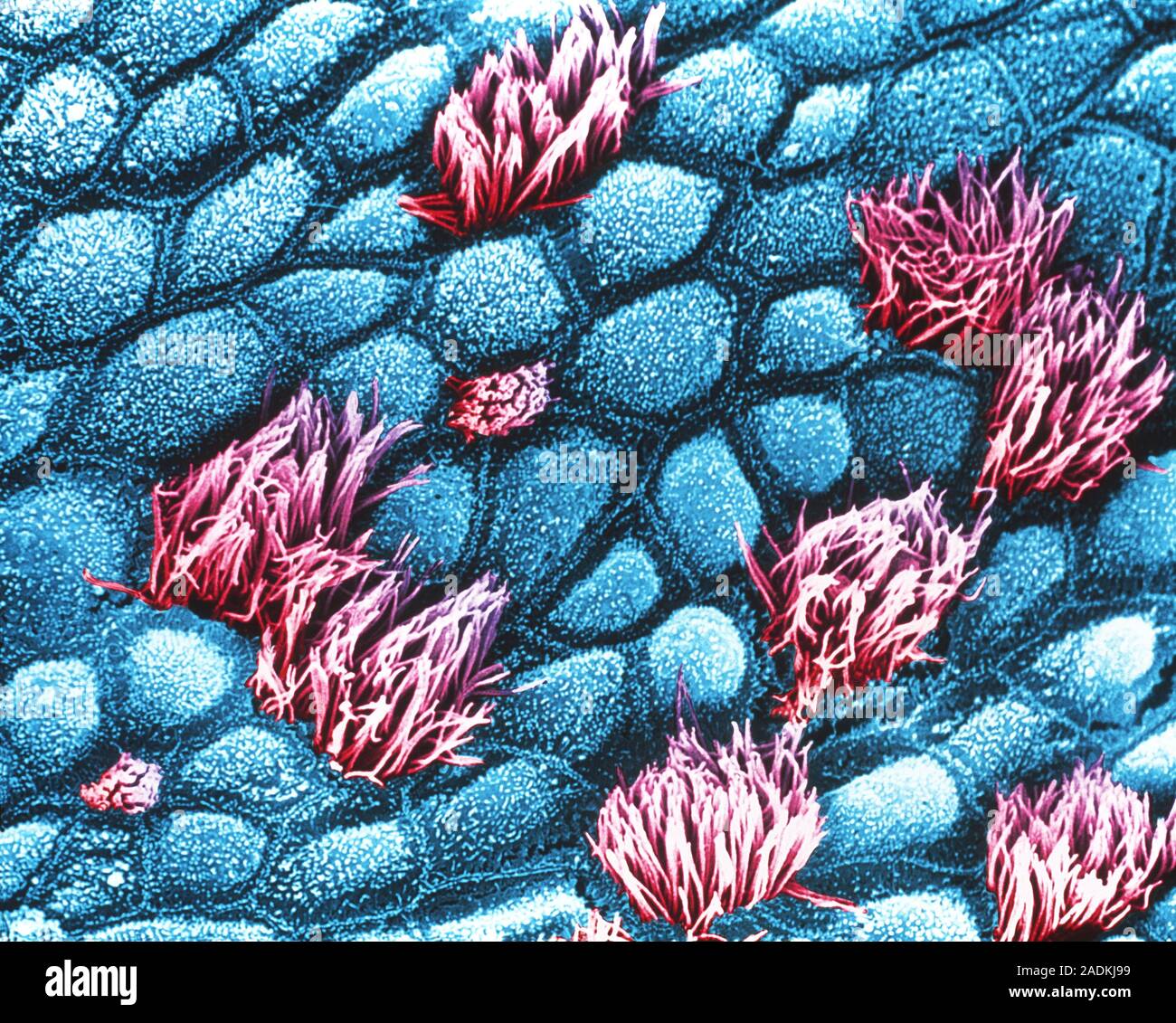 Trachea. Coloured scanning electron micrograph (SEM) of epithelial ...