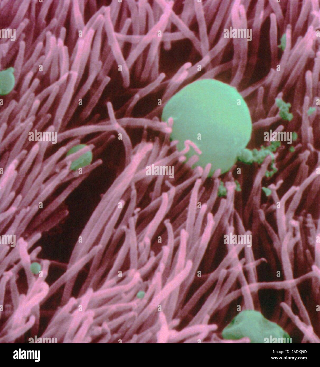 Tracheal epithelium. Coloured scanning electron micrograph (SEM) of ...