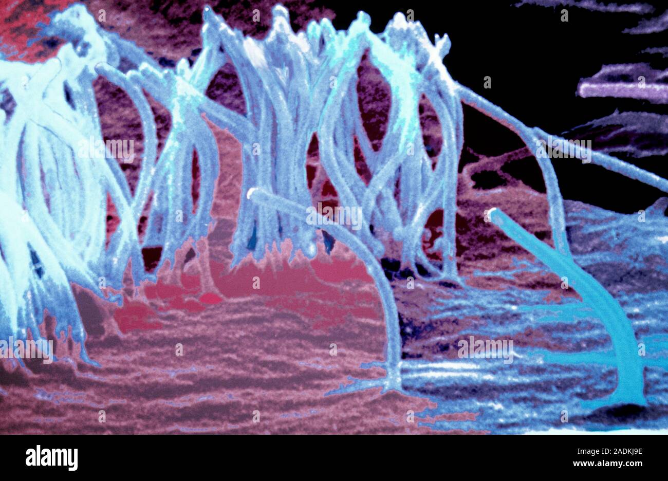 Tracheal epithelium. Coloured scanning electron micrograph (SEM) of ...