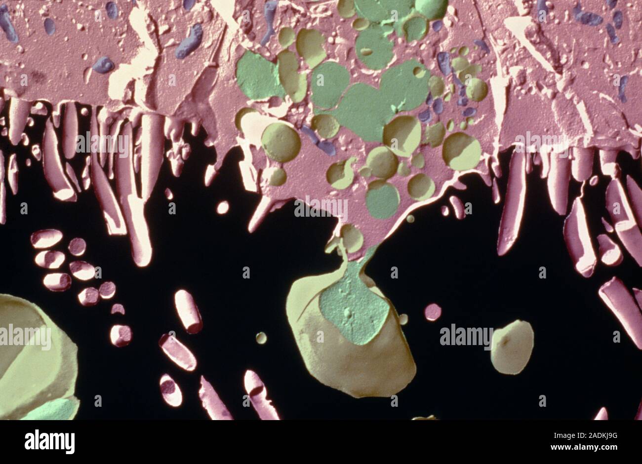 Tracheal epithelium. Coloured freeze-fracture transmission electron ...
