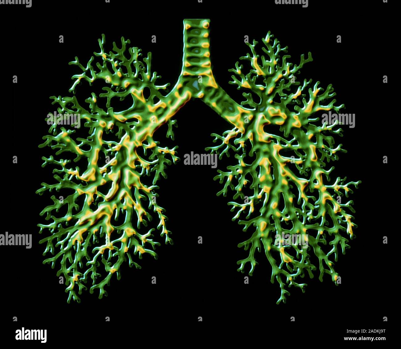 Lung airways. Computer-enhanced image of a resin cast of the airways in ...