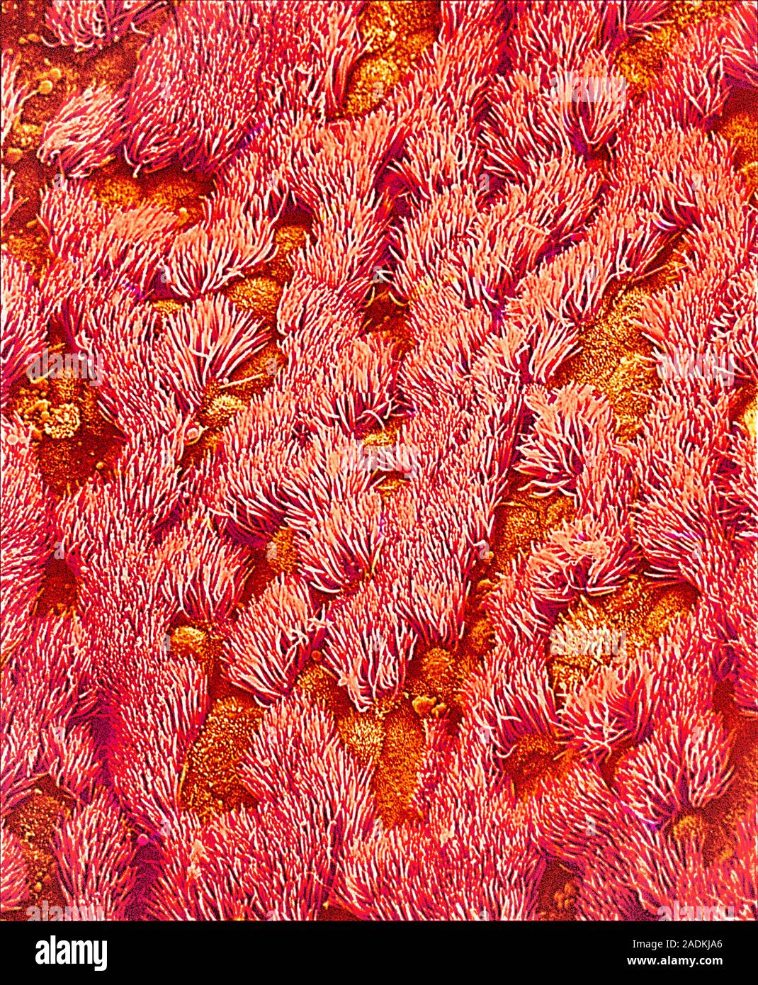 Trachea. Coloured scanning electron micrograph (SEM) of the lining of ...