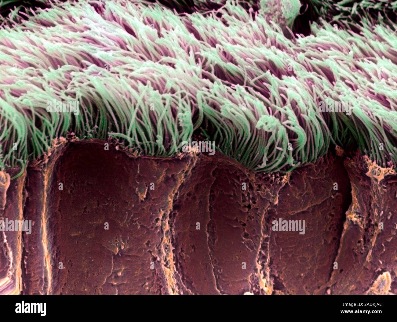Bronchial cilia. Coloured scanning electron micrograph (SEM) of a ...