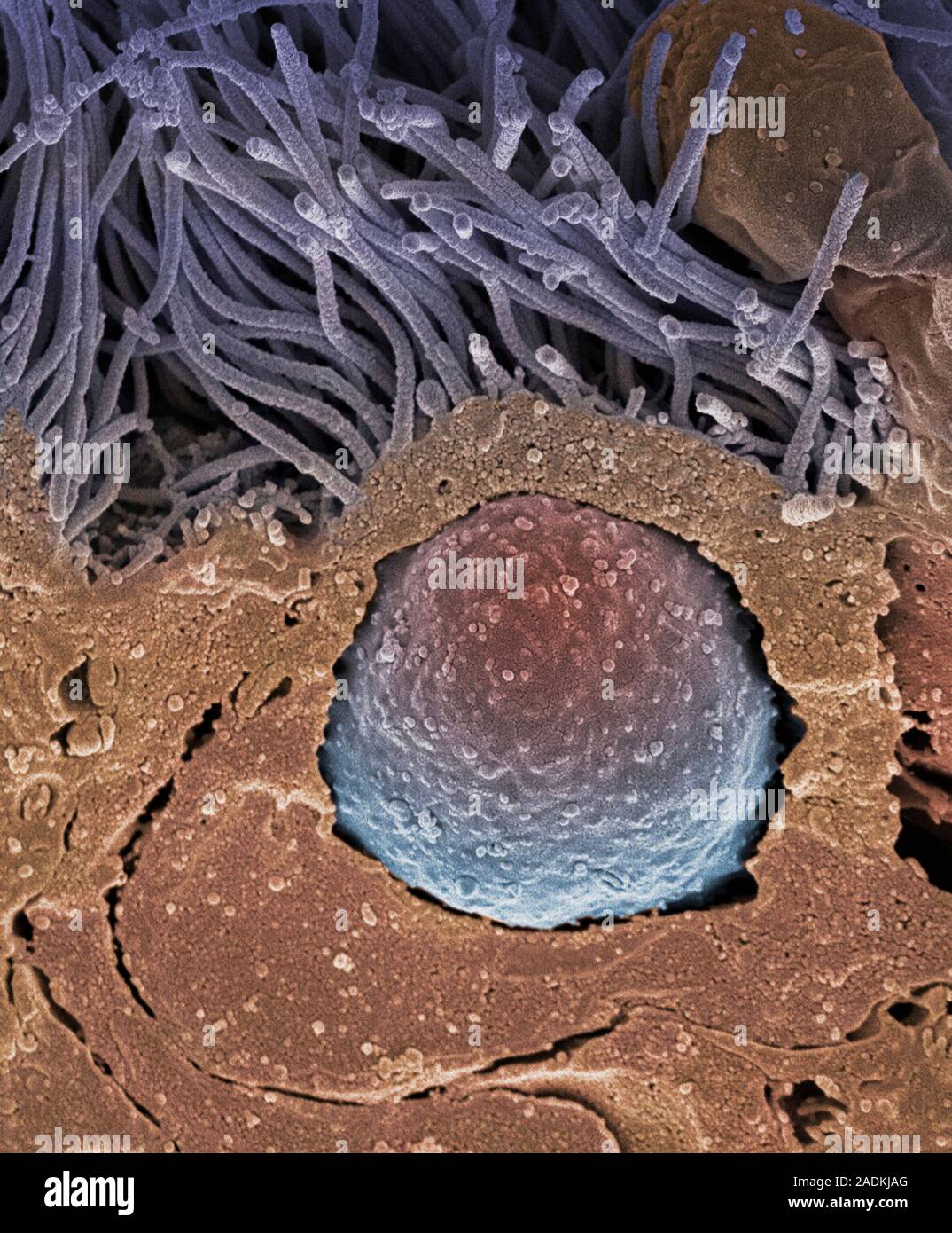Trachea lining. Coloured scanning electron micrograph (SEM) of a freeze ...