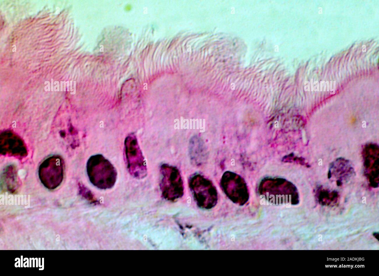 Lung cells. Light micrograph of a section through the wall of a ...