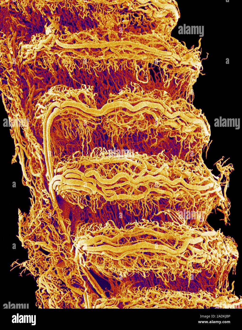 Trachea. Coloured scanning electron micrograph (SEM) of the exterior of ...