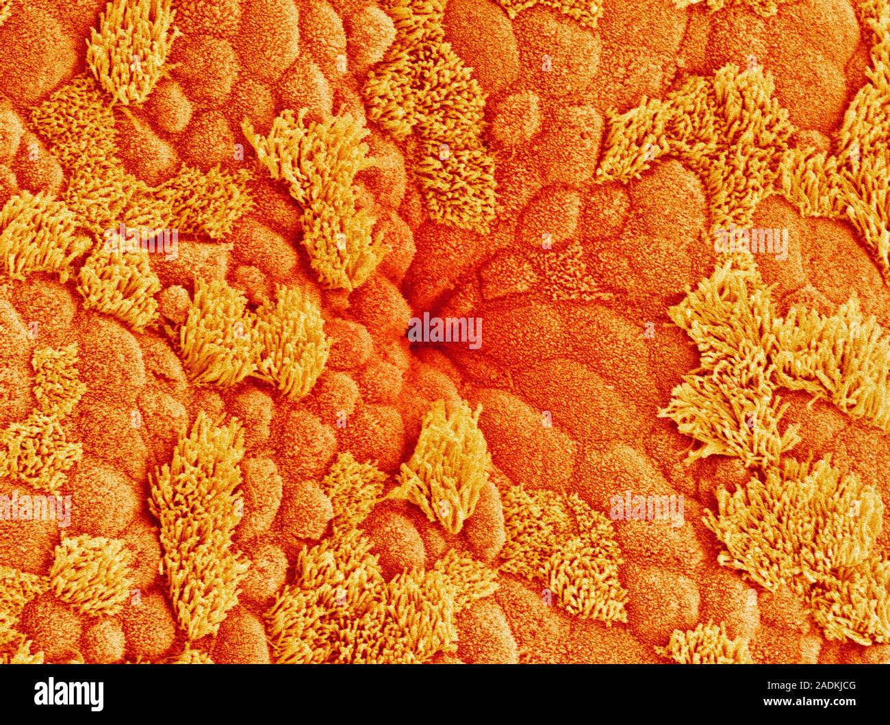 Trachea lining. Coloured scanning electron micrograph (SEM) of the ...