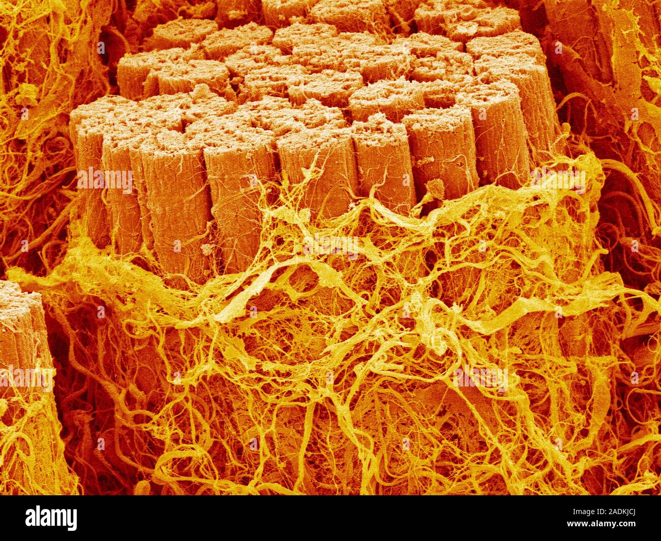 Trachea muscle. Coloured scanning electron micrograph (SEM) of smooth ...