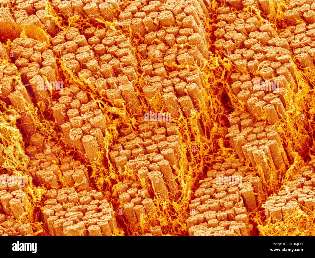 Trachea muscle. Coloured scanning electron micrograph (SEM) of smooth ...