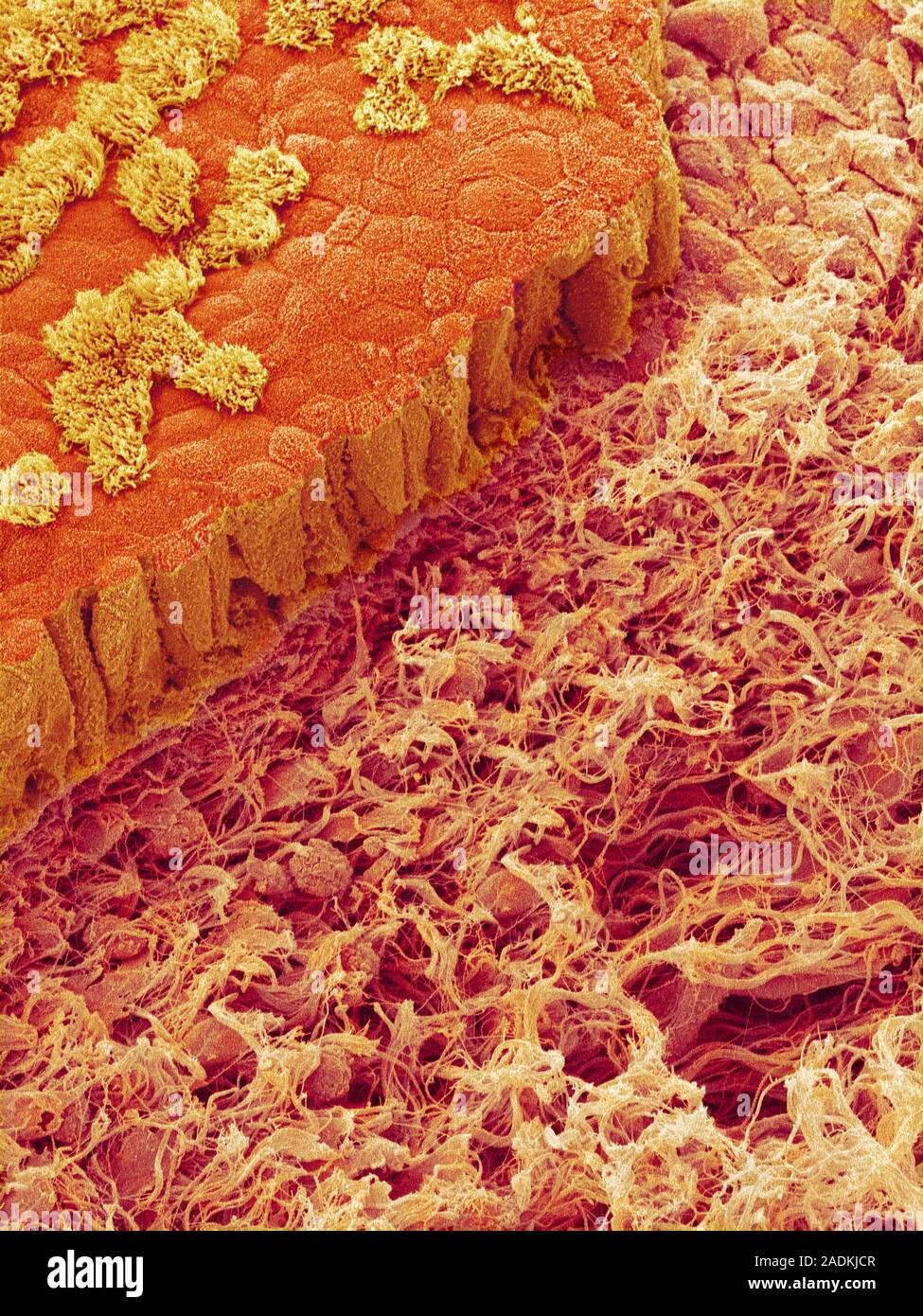 Trachea lining. Coloured scanning electron micrograph (SEM) of a ...