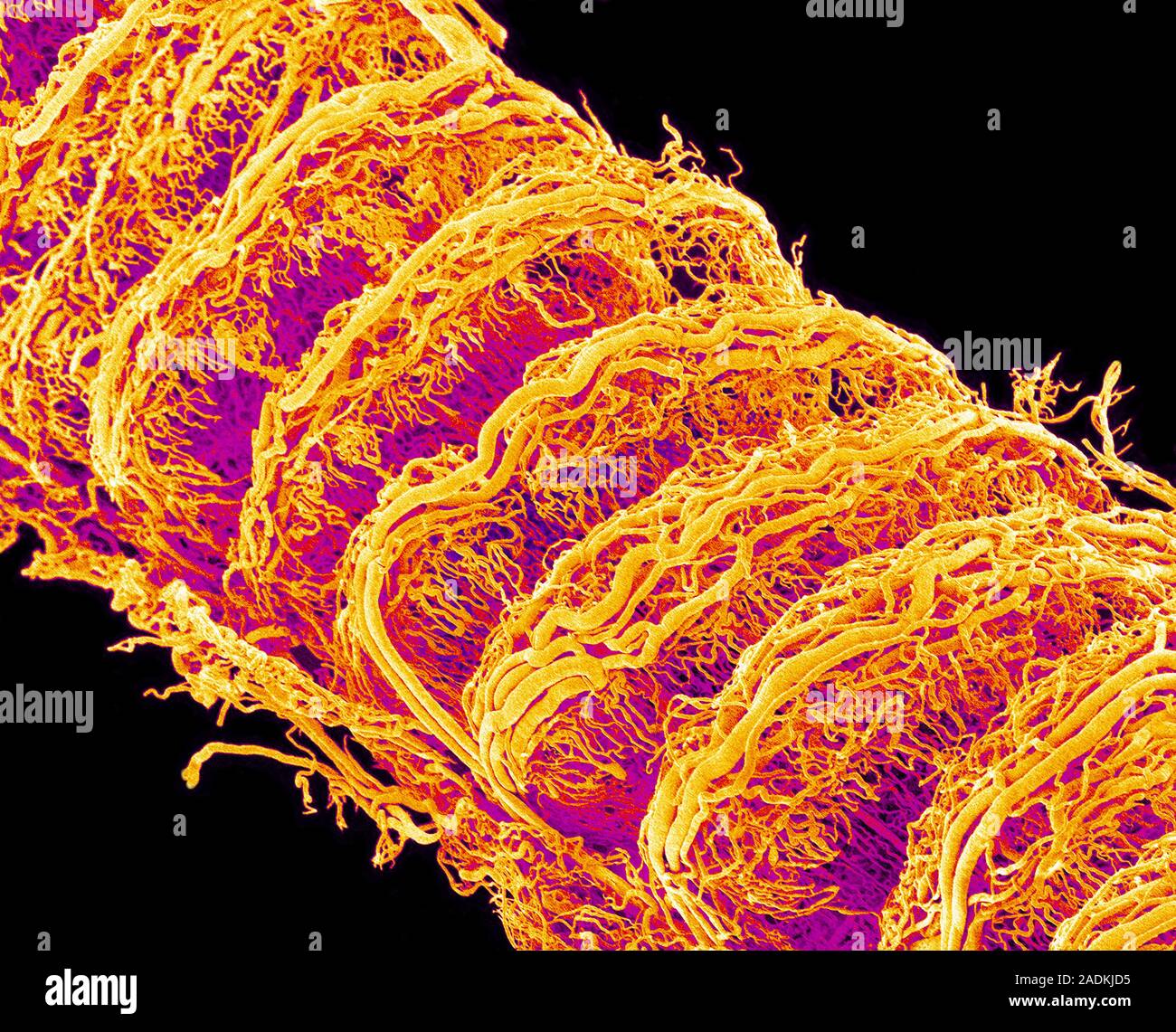 Trachea. Coloured scanning electron micrograph (SEM) of the exterior of ...