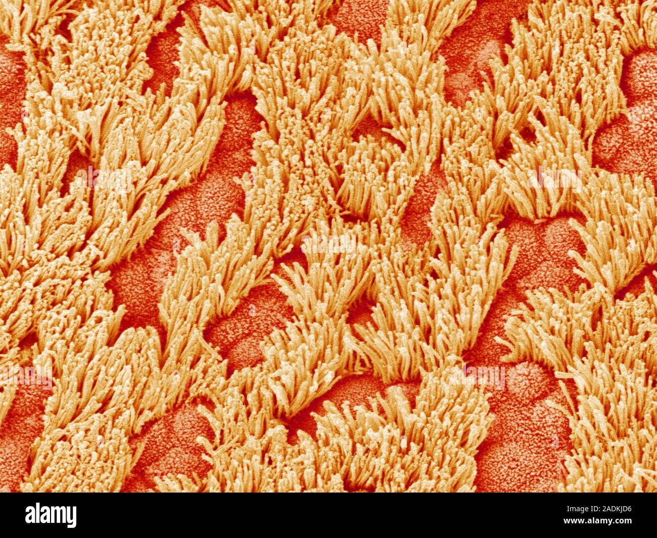 Trachea lining. Coloured scanning electron micrograph (SEM) of the ...