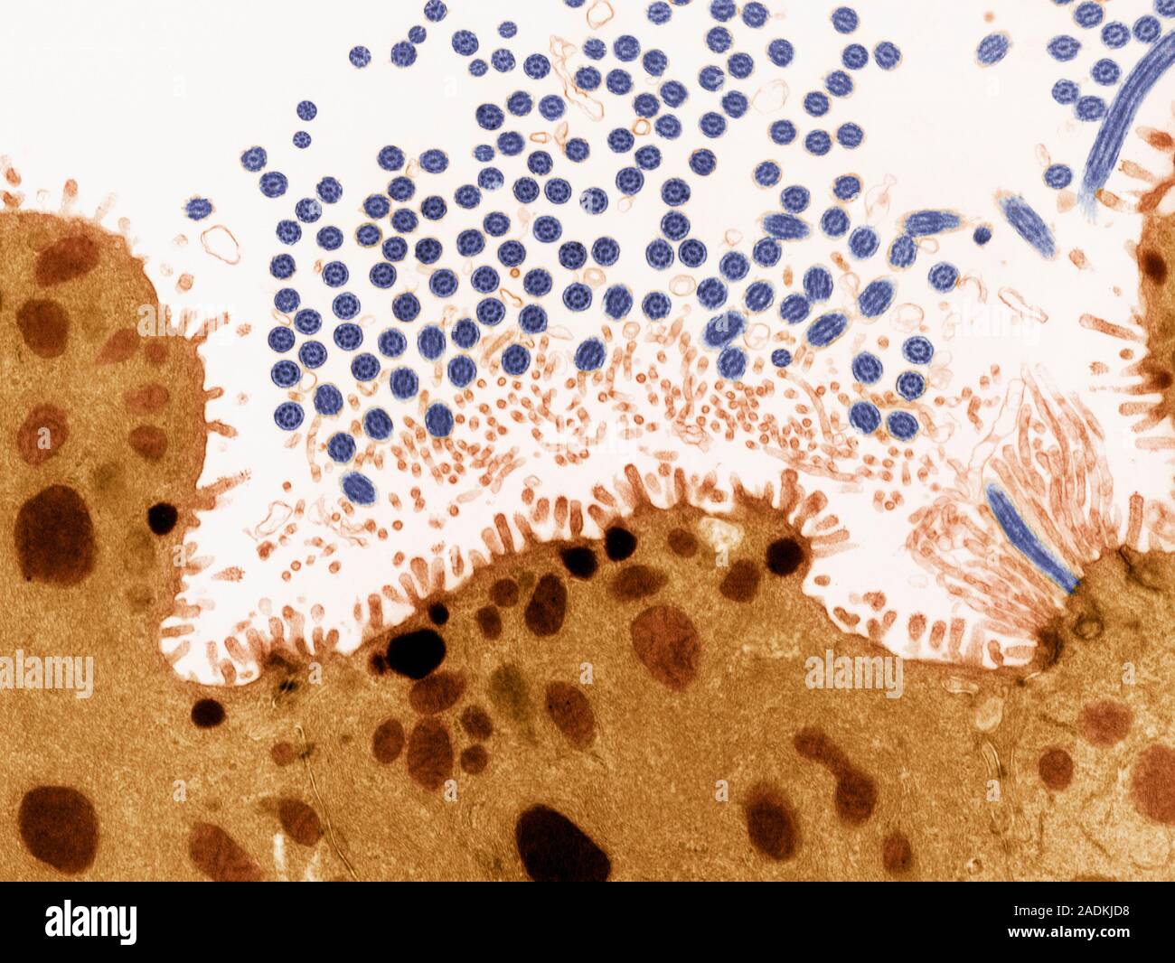 Trachea lining. Coloured transmission electron micrograph (TEM) of a ...
