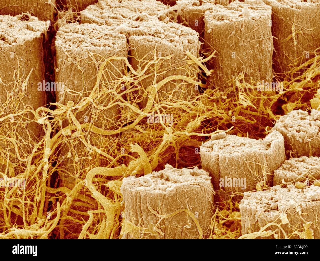 Trachea muscle. Coloured scanning electron micrograph (SEM) of smooth ...