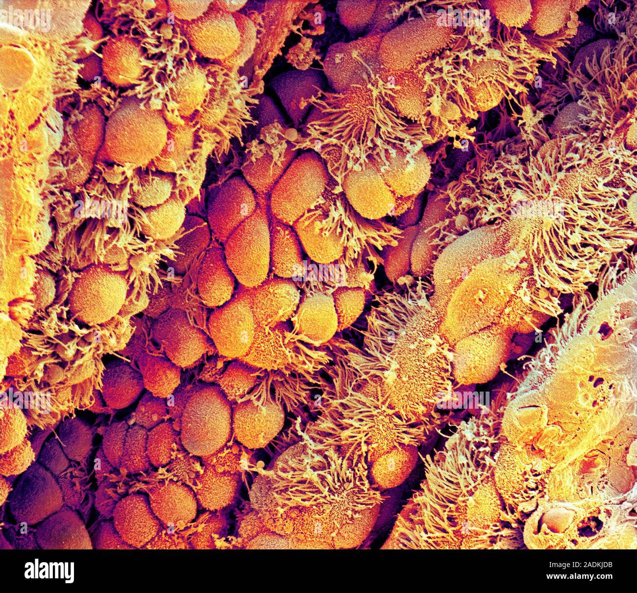 Lung lining. Coloured scanning electron micrograph (SEM) of mucus ...
