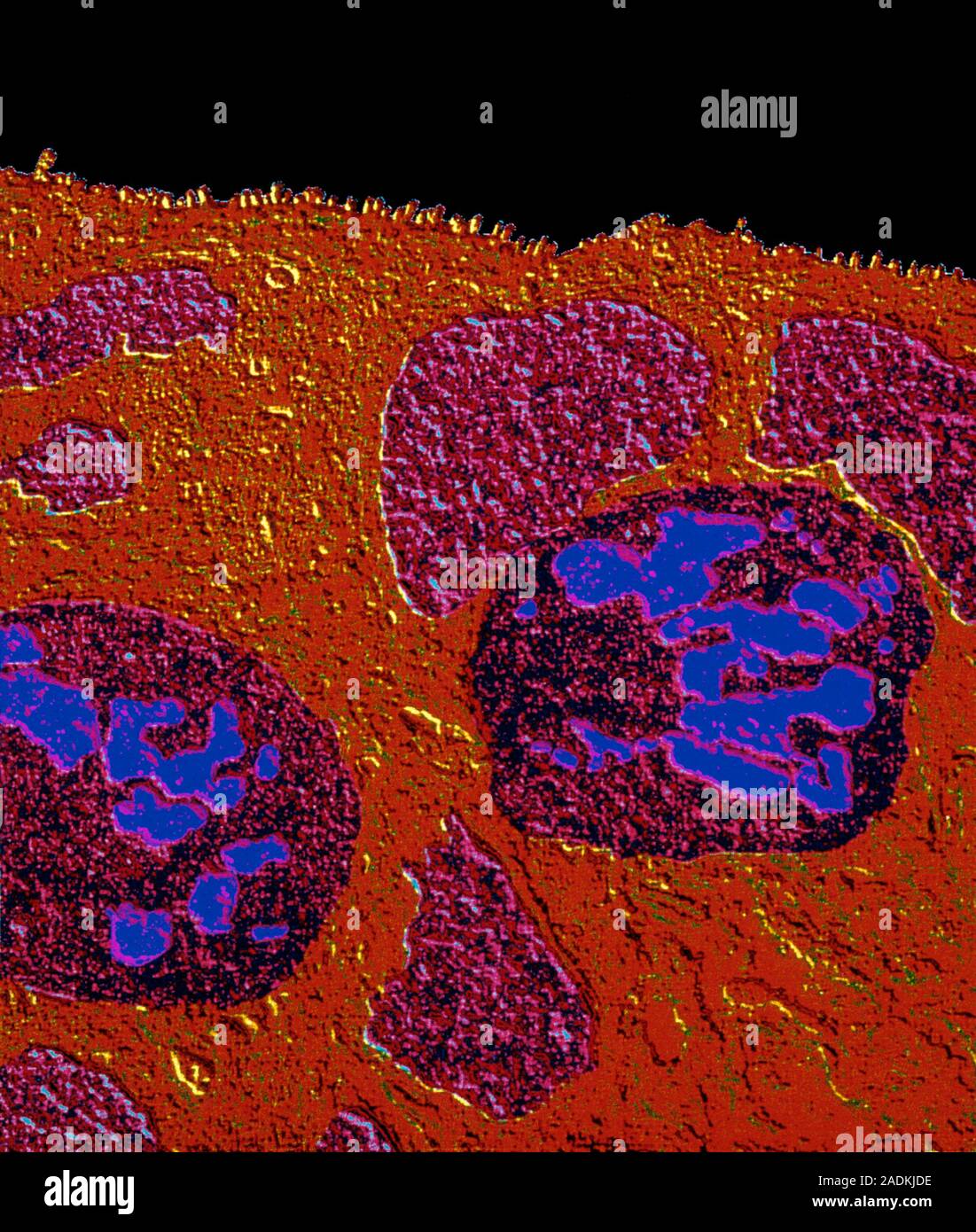 Tracheal epithelium. Coloured transmission electron micrograph (TEM) of ...
