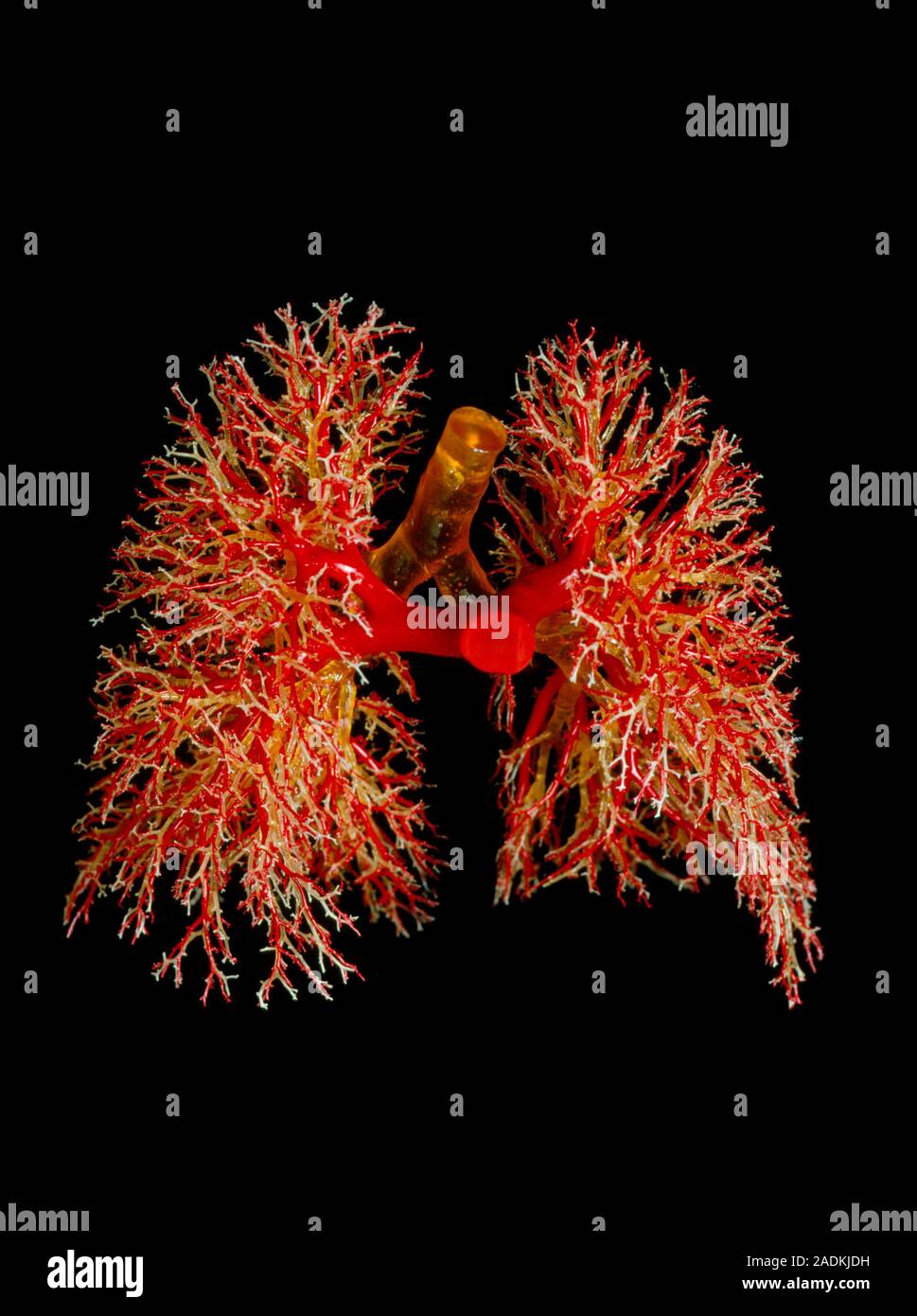 Resin cast of the pulmonary arteries and bronchi supplying blood and ...